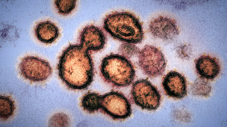 Watch Coronavirus, Explained | Netflix Official Site